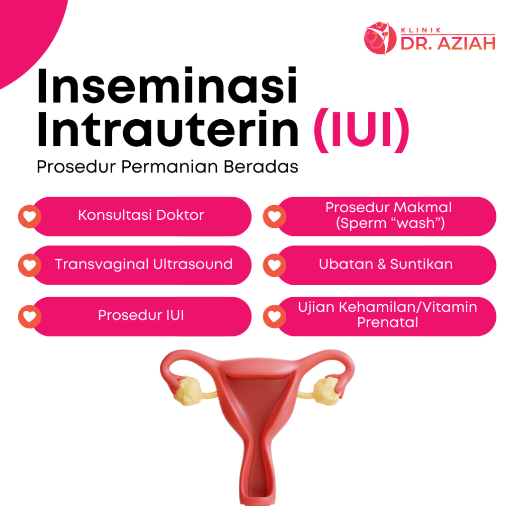 Deposit : Prosedur Intrauterine Insemination (IUI) - Klinik Dr Aziah